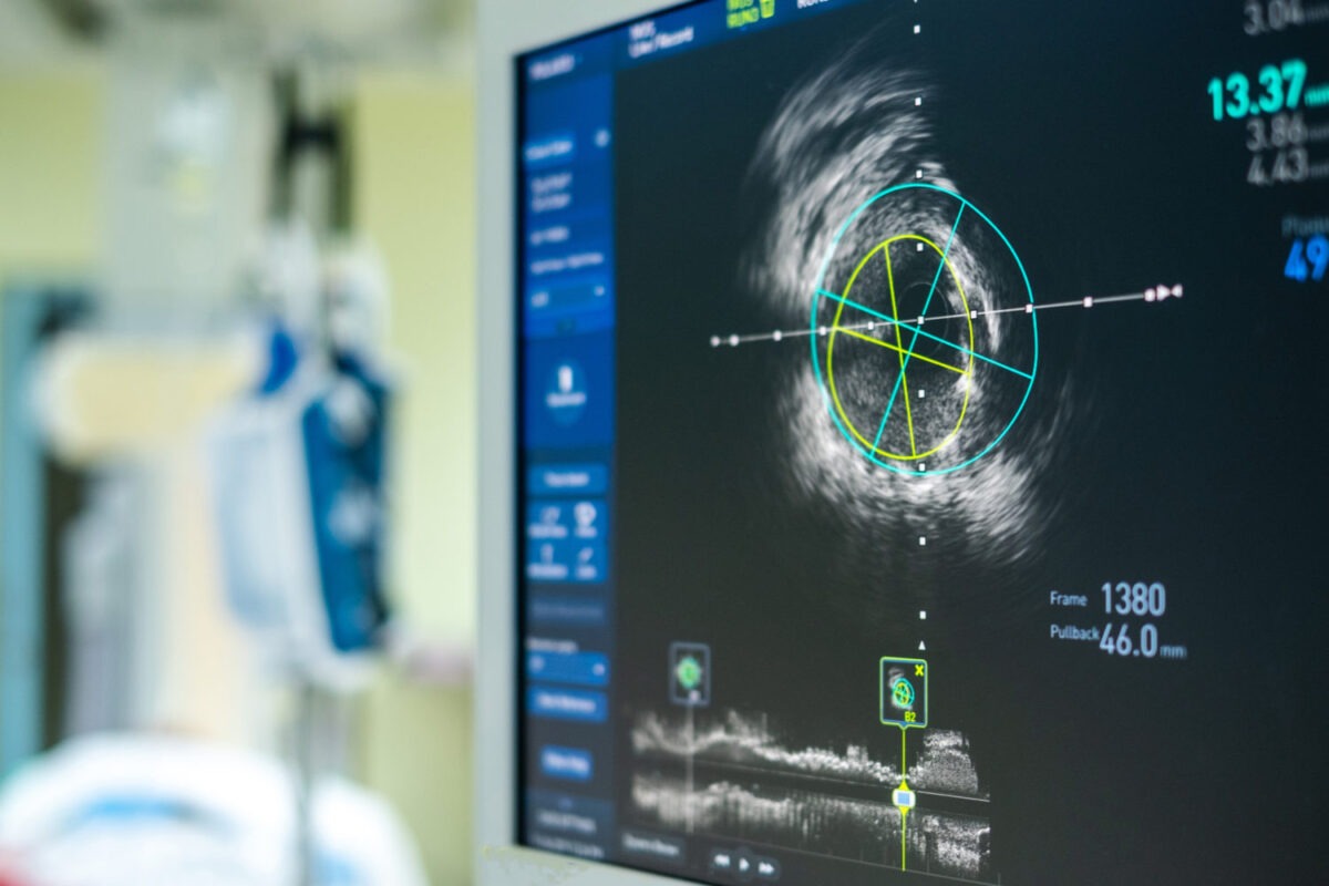 Abdominal Aorta ultrasound | ApexHealth